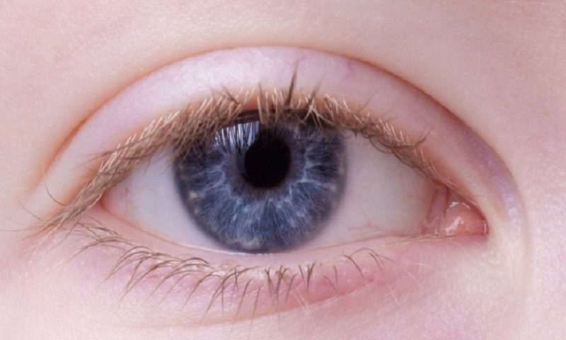 Párpados hinchados: Causas y tratamientos - Arte Final Radio